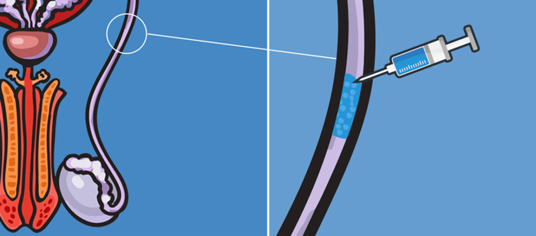 Verhütung für Männer - Ein Überblick - medaVital • Erfahrungen | Studien